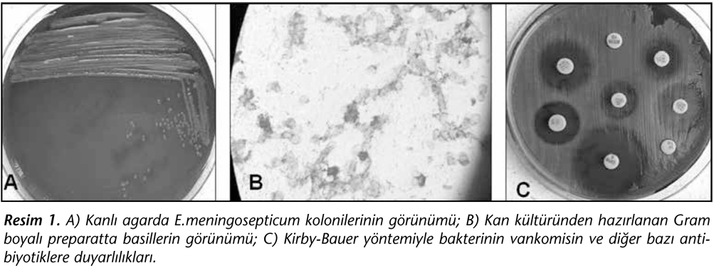 İzolatınTanımlanması ve Antibiyotik Duyarlılığı